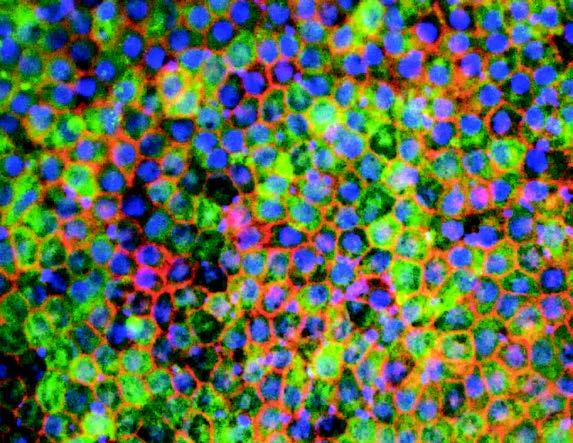 Science fiction? Male and Female Stem Cells Derived from the Same ...